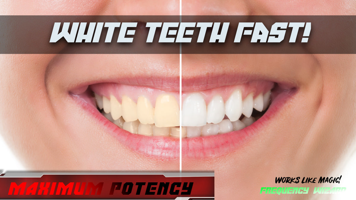 Get White Teeth Fast! (Revamped) – Frequency Wizard Get White Teeth Fast! (Revamped) – Frequency Wizard